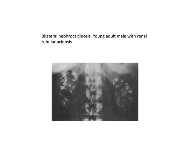 Renal radilogy | PPTX