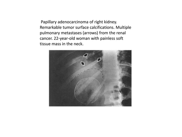 Renal radilogy | PPT