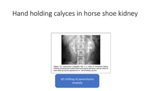 Renal radiology revision notes | PDF