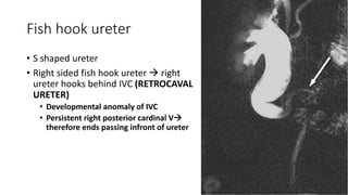 Renal radiology revision notes | PDF