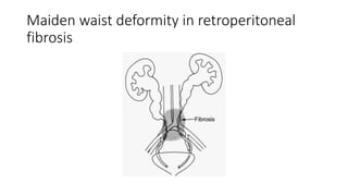 Renal radiology revision notes | PDF