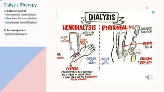 Renal Replacement Therapy Different Modalities.pdf