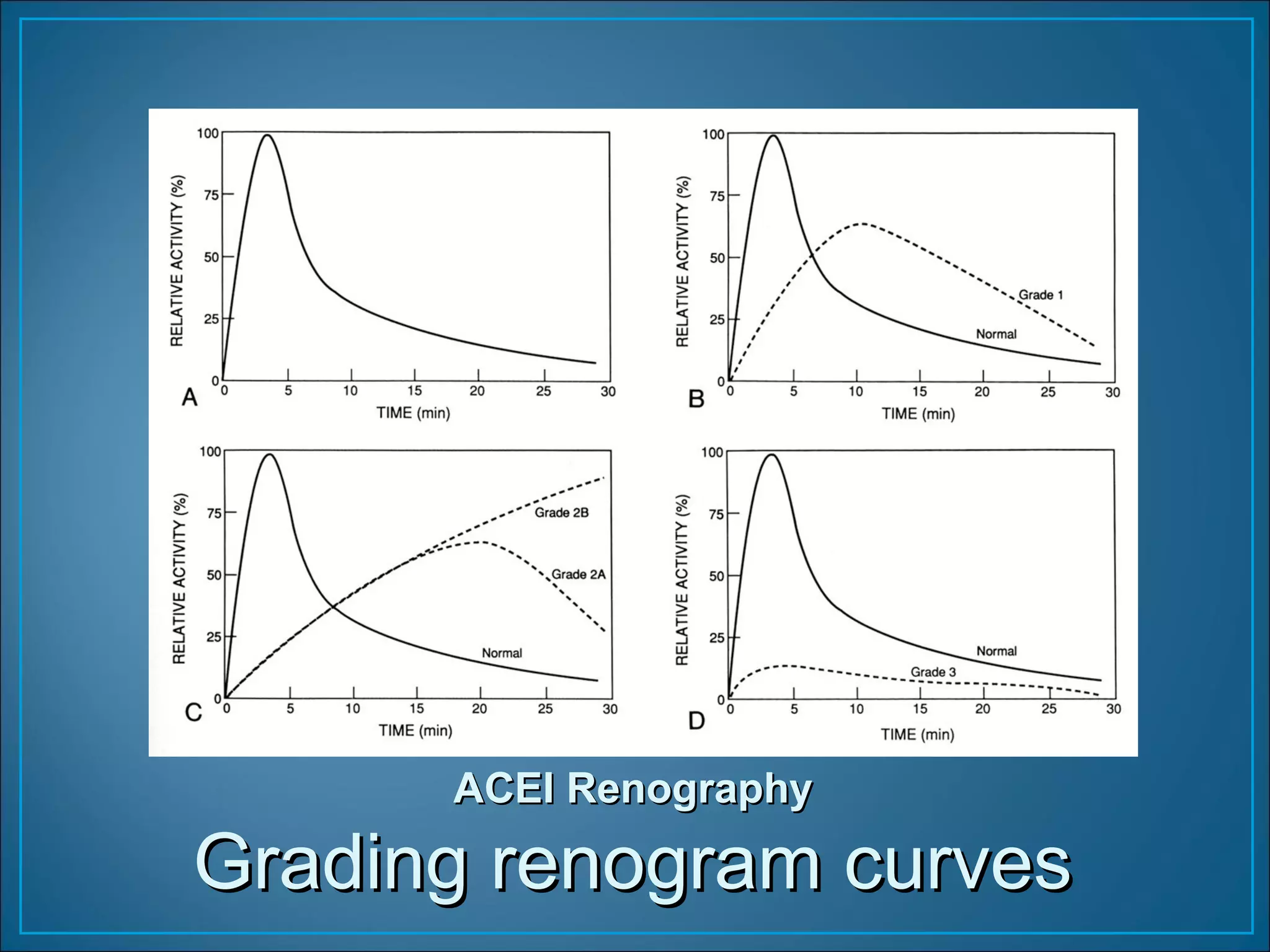Renal scintigraphy | PPT
