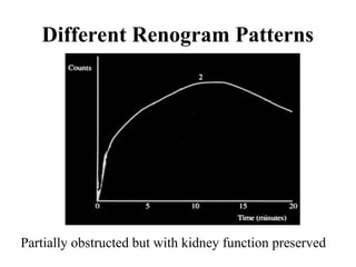 all about renal scan Renal Scintigraphy-.ppt