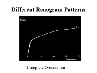 all about renal scan Renal Scintigraphy-.ppt