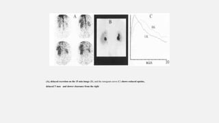 RENAL SCINTIGRAPHY, ADRENAL SCINTIGRAPHY AND ADRENAL VENOUS.pptx