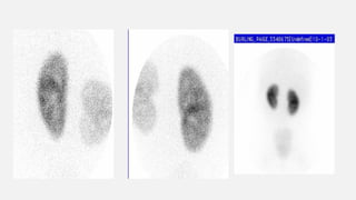 RENAL SCINTIGRAPHY, ADRENAL SCINTIGRAPHY AND ADRENAL VENOUS.pptx