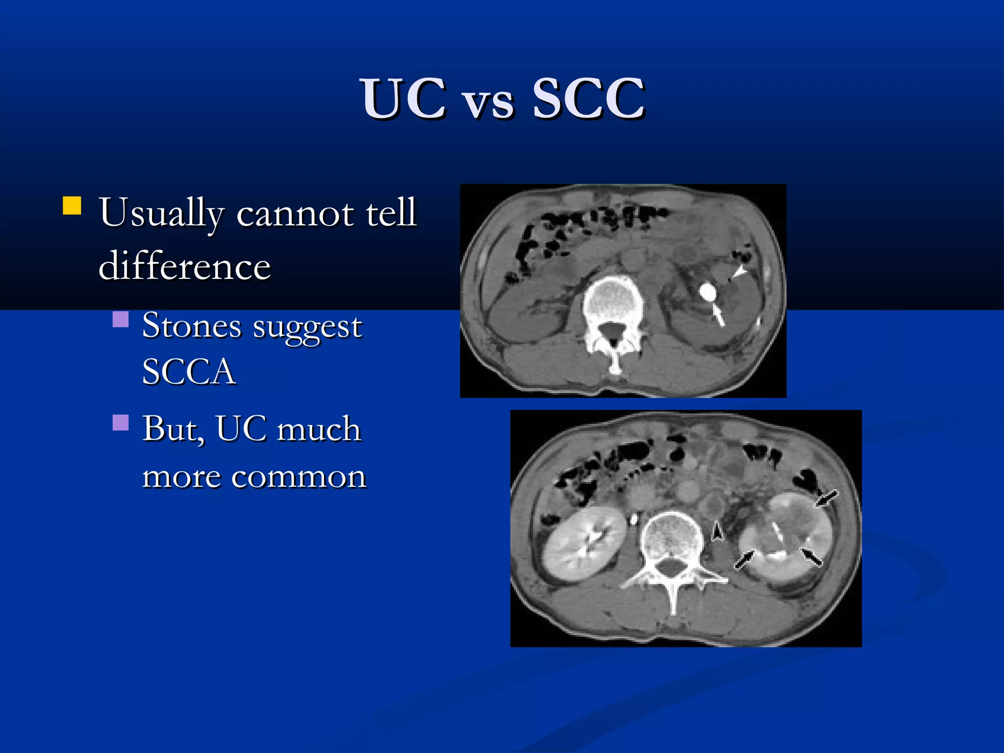 Renal sinus | PPT