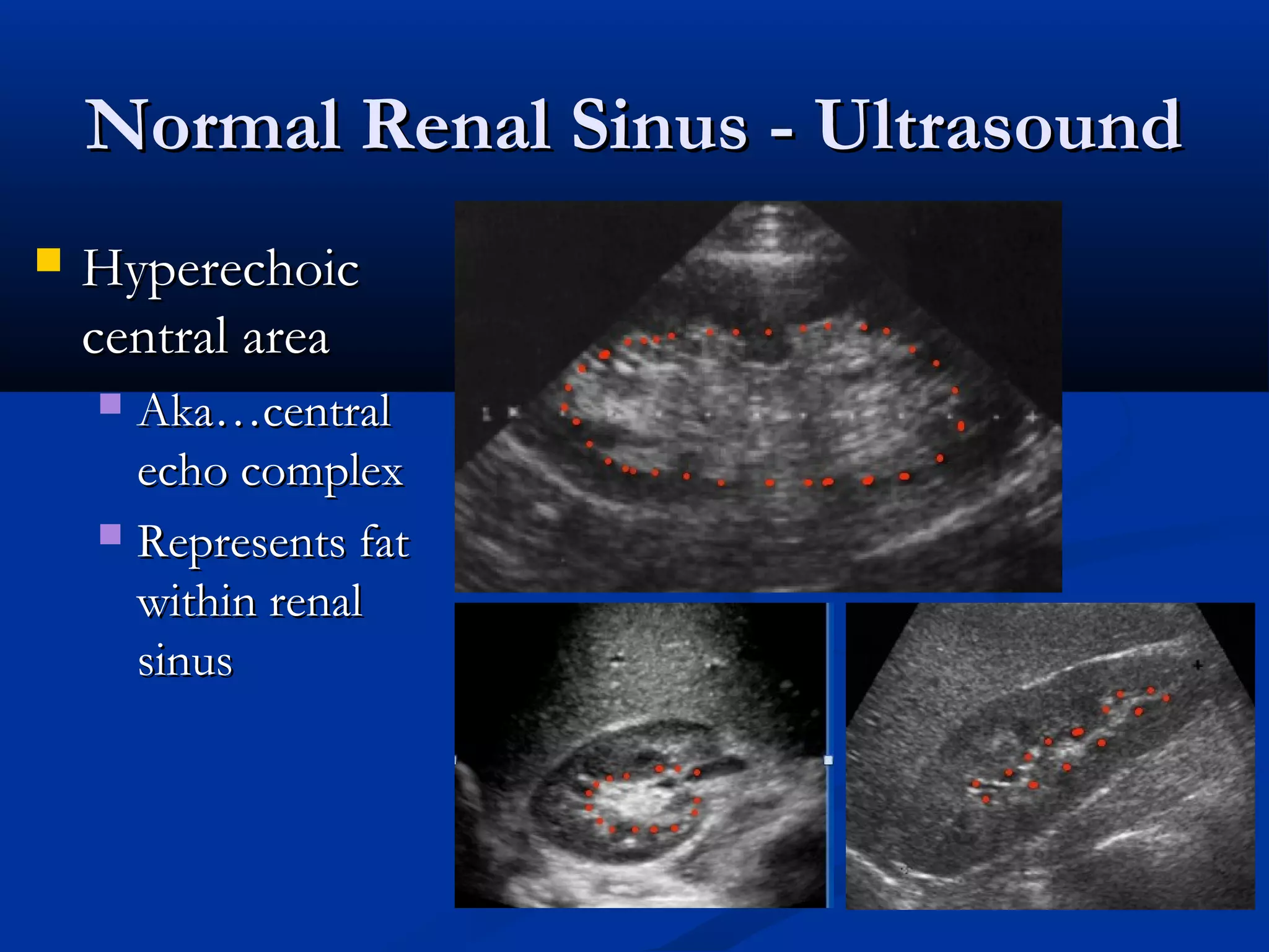 Renal sinus | PPT