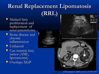 Renal Sinus Ultrasound