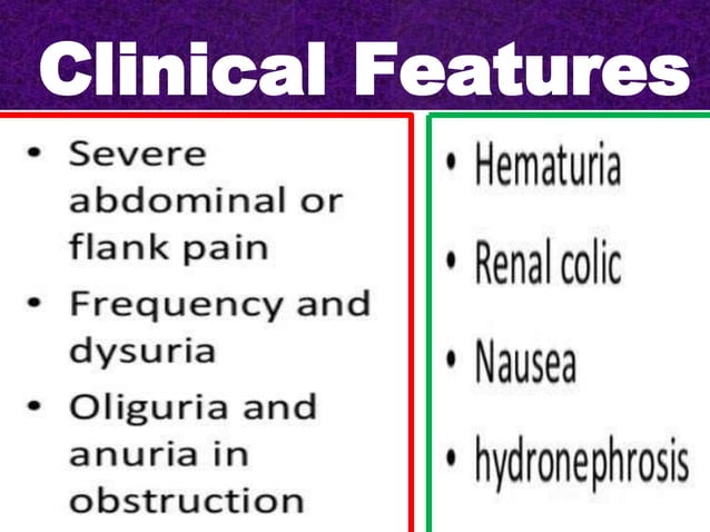 renal stone.ppt
