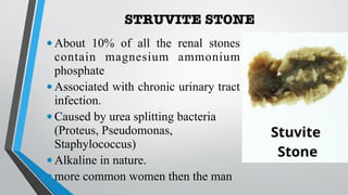 renal stone.pdf