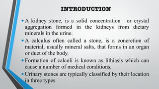 renal stone.pdf