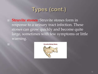 Renal Stone Medical Surgical nursing.pptx