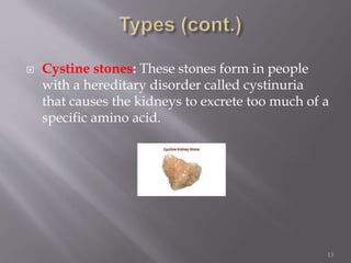 Renal Stone Medical Surgical nursing.pptx
