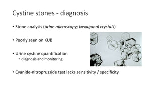 Renal stone disease | PPTX