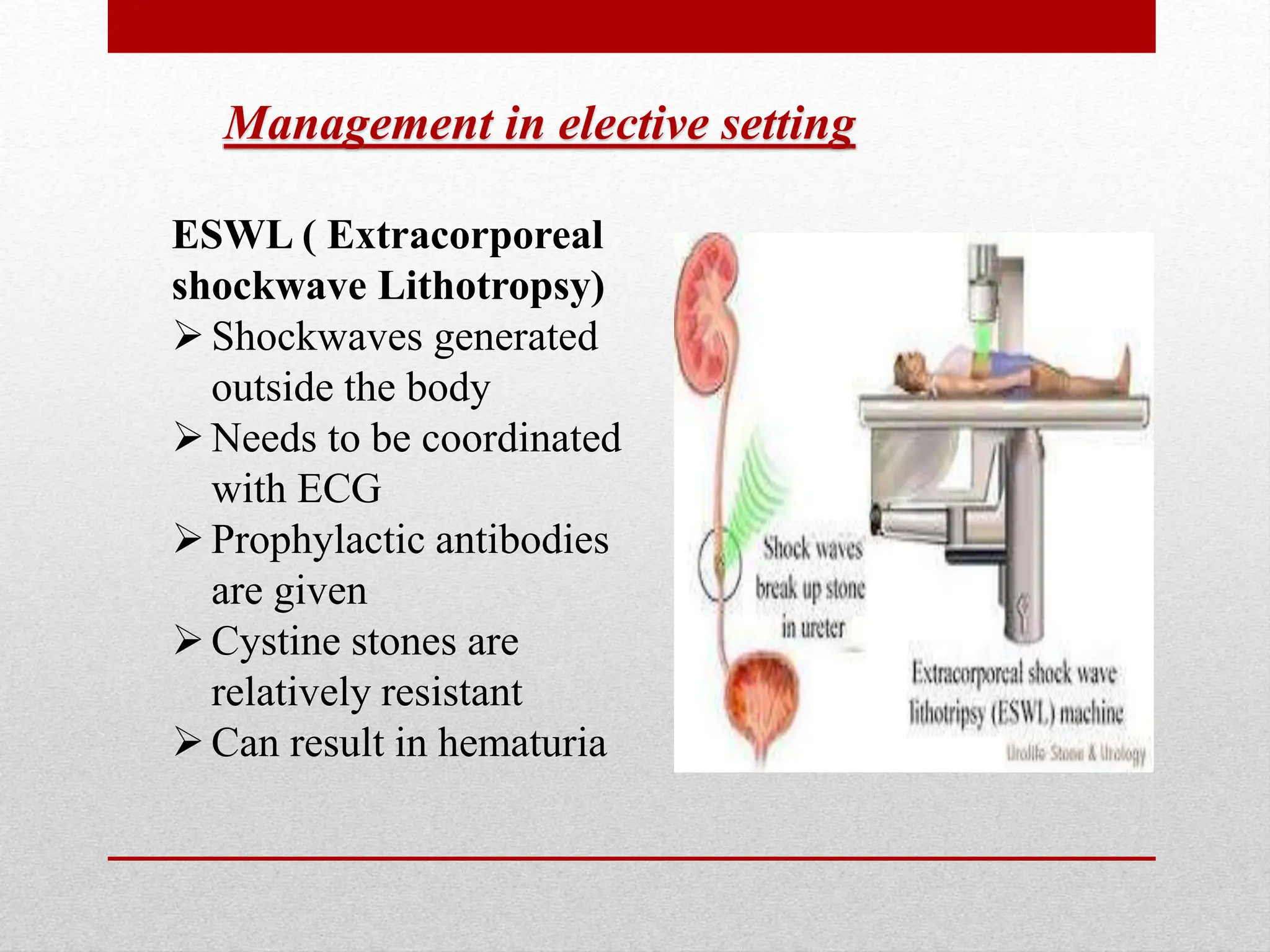 Renal Stone Diseases.pptx.....defination | PPTX