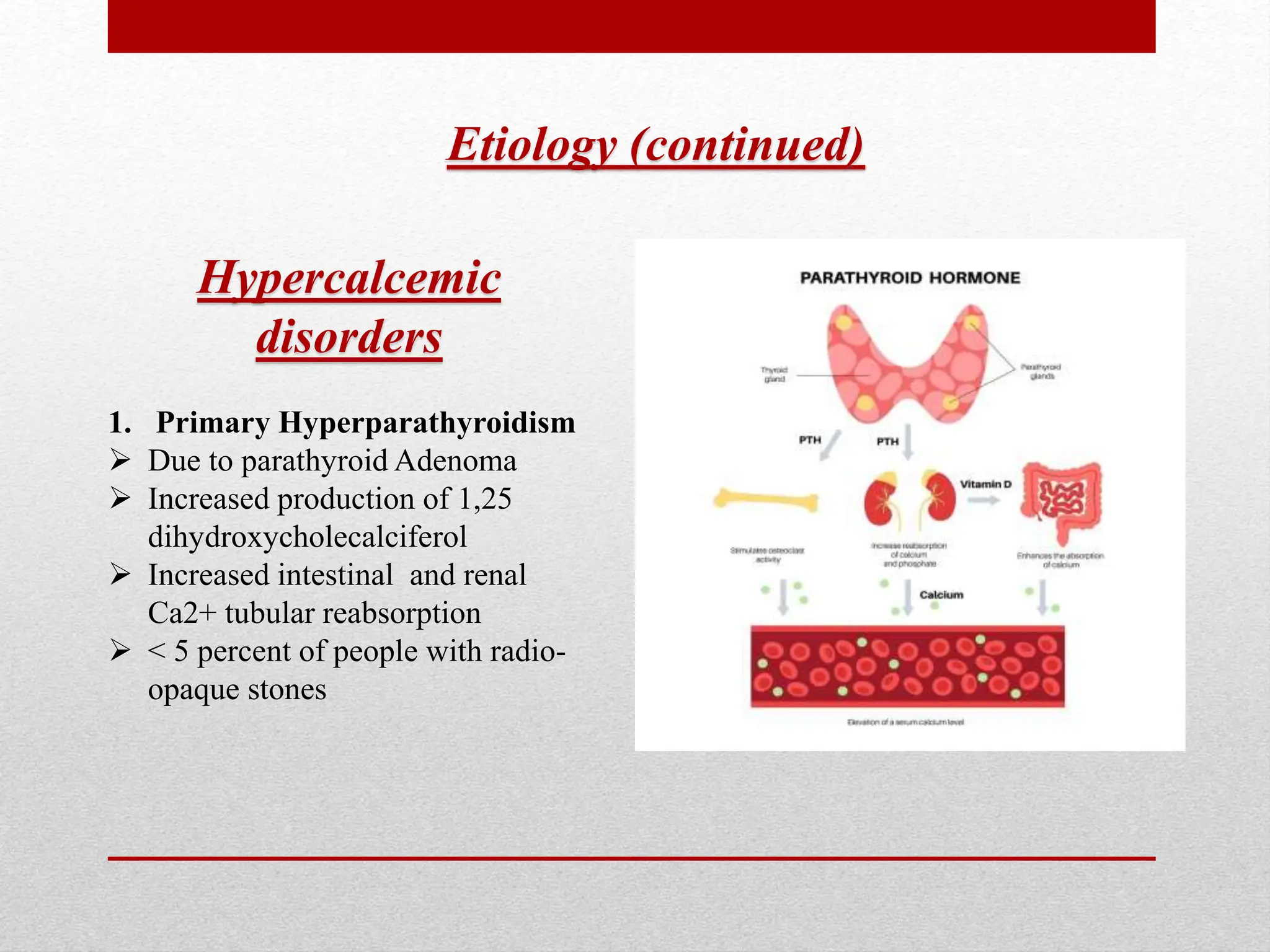 Renal Stone Diseases.pptx.....defination | PPTX