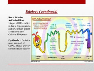 Renal Stone Diseases.pptx.....defination | PPT
