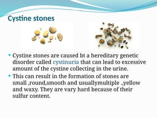 RENAL STONES,Definition types,causes ,risk factor | PPTX