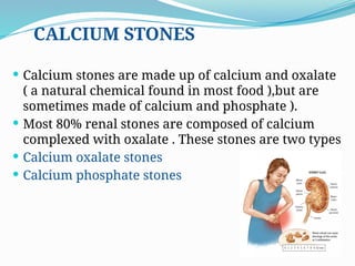RENAL STONES,Definition types,causes ,risk factor | PPTX