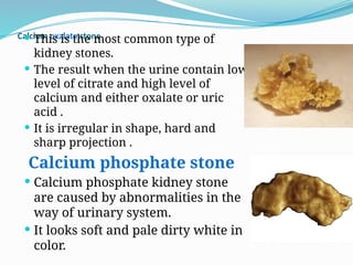RENAL STONES,Definition types,causes ,risk factor | PPTX