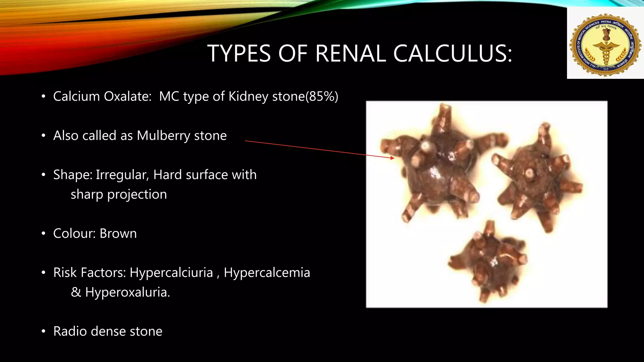 Kidney Stone By Dr ANIL KUMAR, Associate Professor( AIIMS-Patna) | PPTX