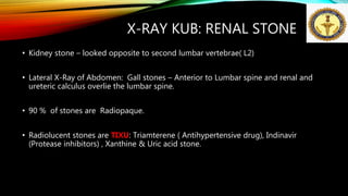Kidney Stone By Dr ANIL KUMAR, Associate Professor( AIIMS-Patna) | PPTX