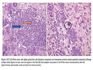 Renal system -DOAP pathology ppt class.ppt