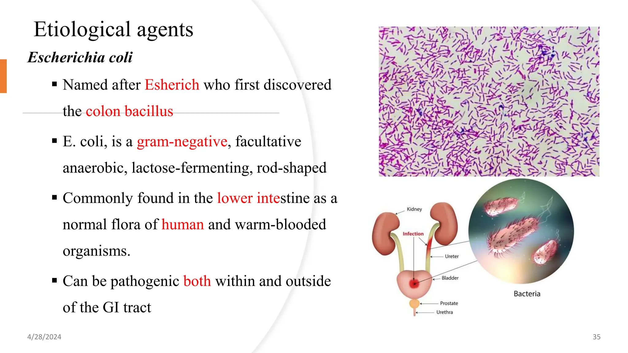 Microbiology of Renal system for medicine students (1).pptx