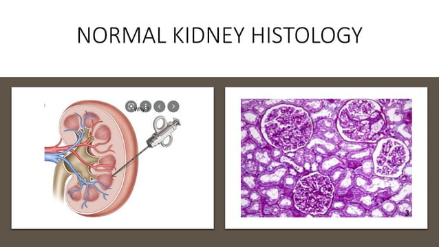 Renal system lecture | PPT