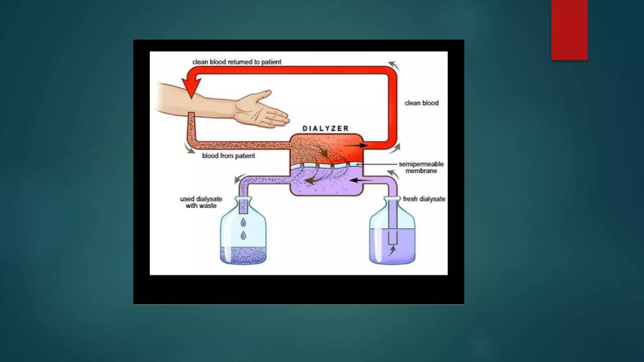 Renal system management | PPTX