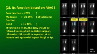 Renal tract anomalies | PPT