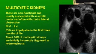 Renal tract anomalies | PPTX