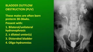 Renal tract anomalies | PPT