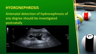 Renal tract anomalies | PPT