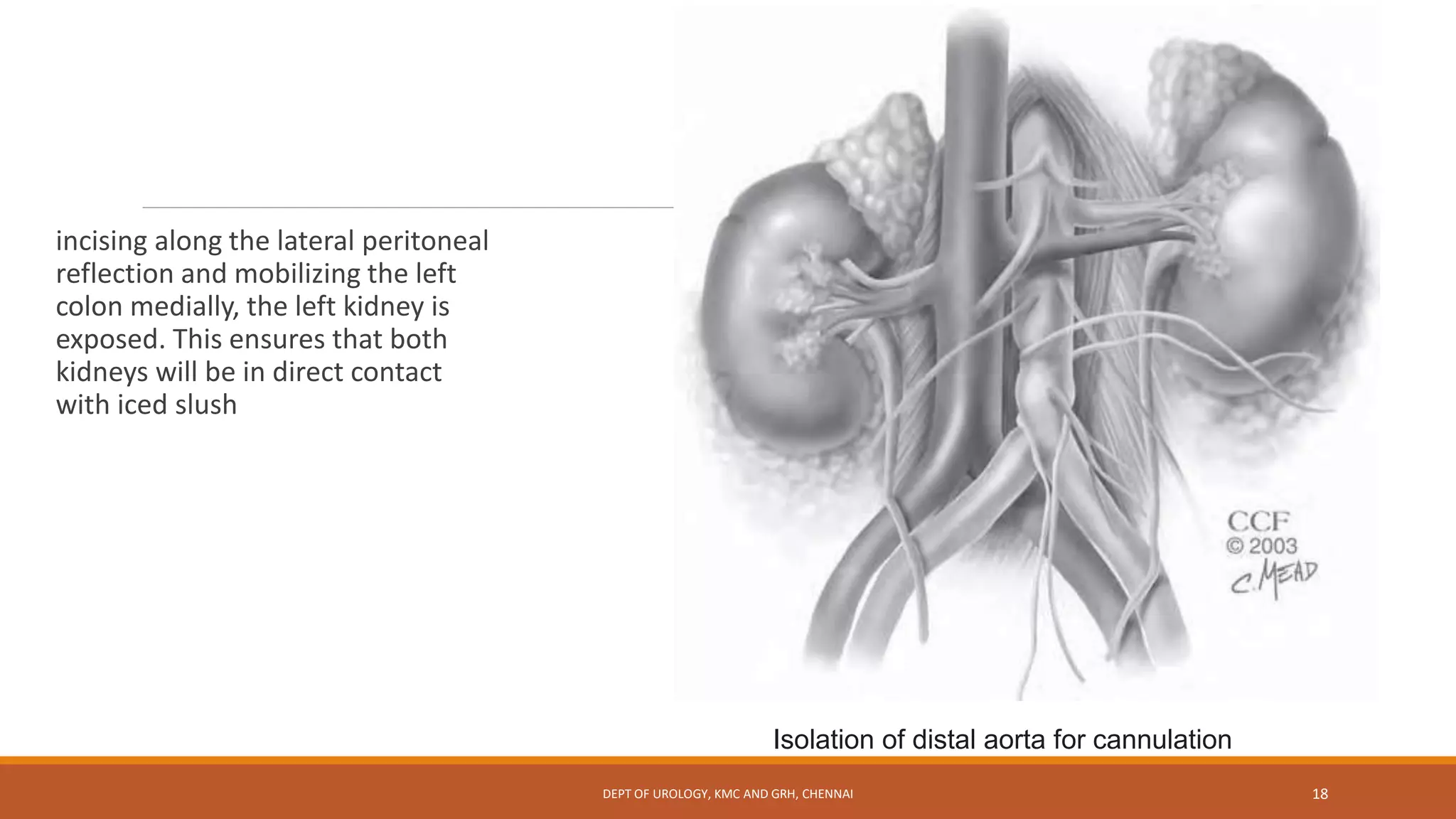 Renal transplant donor- nephrectomy | PDF