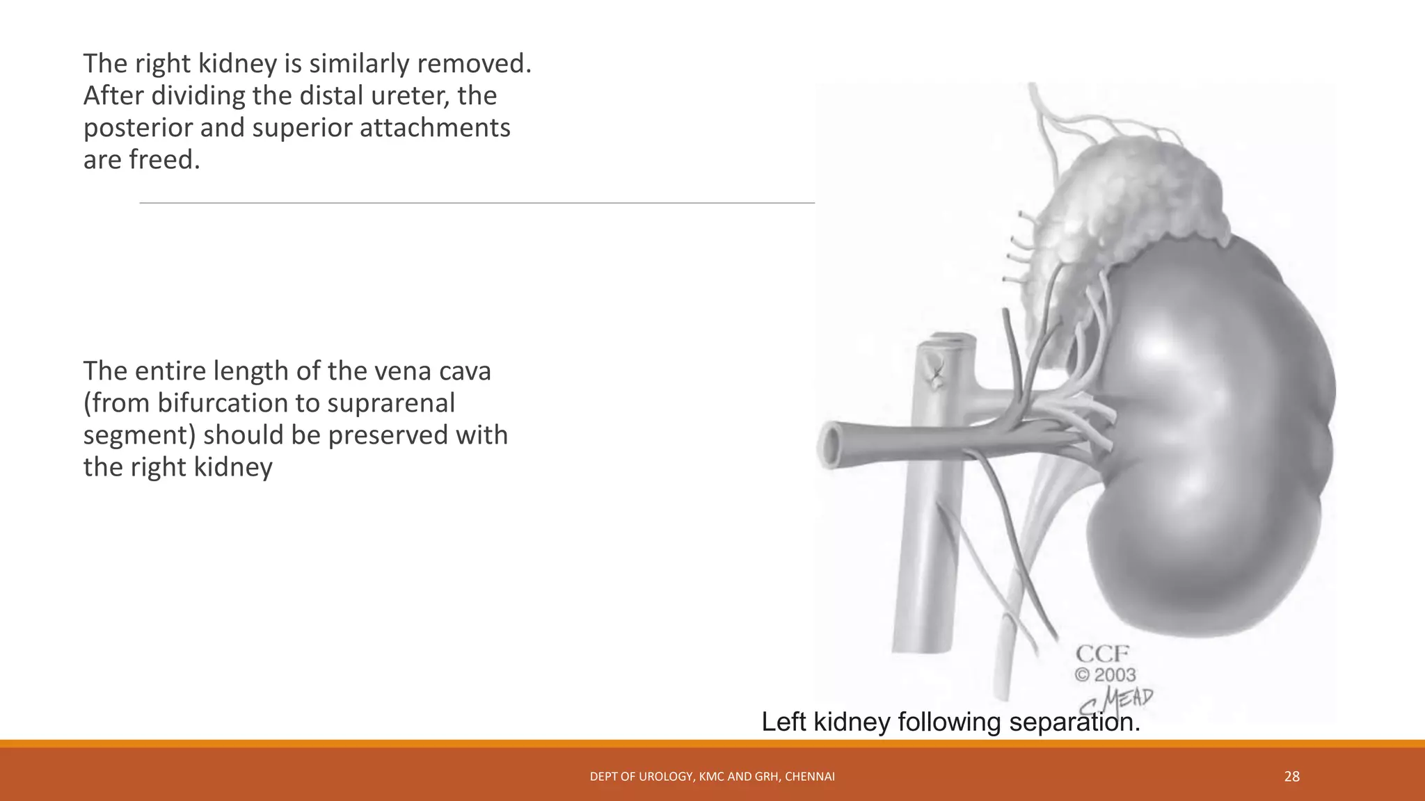 Renal transplant donor- nephrectomy | PDF