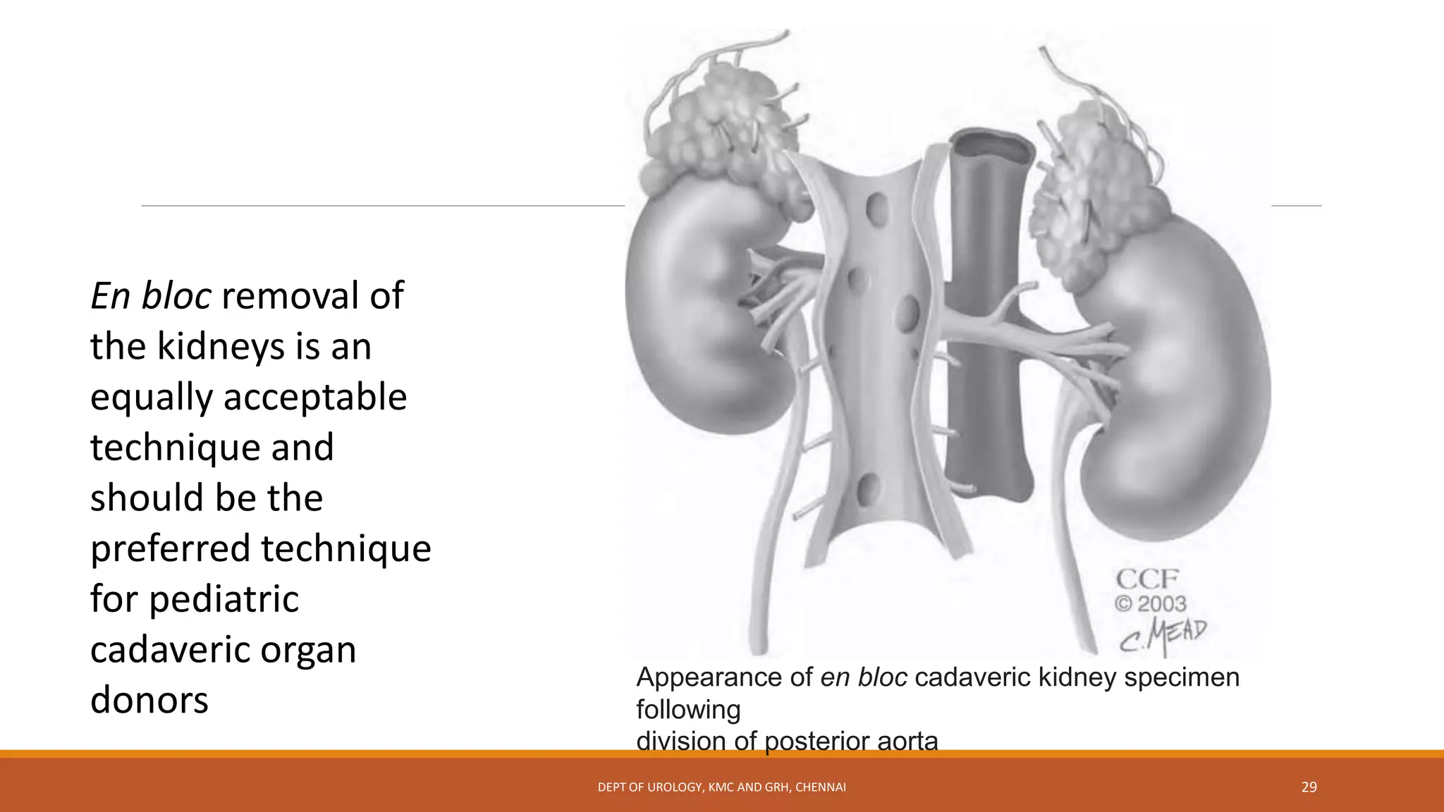 Renal transplant donor- nephrectomy | PDF