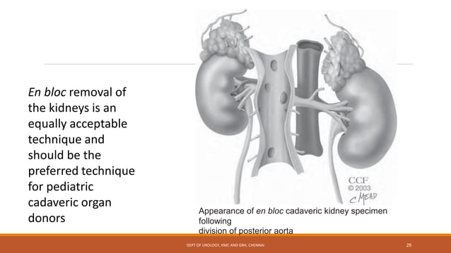 Renal transplant donor- nephrectomy | PDF