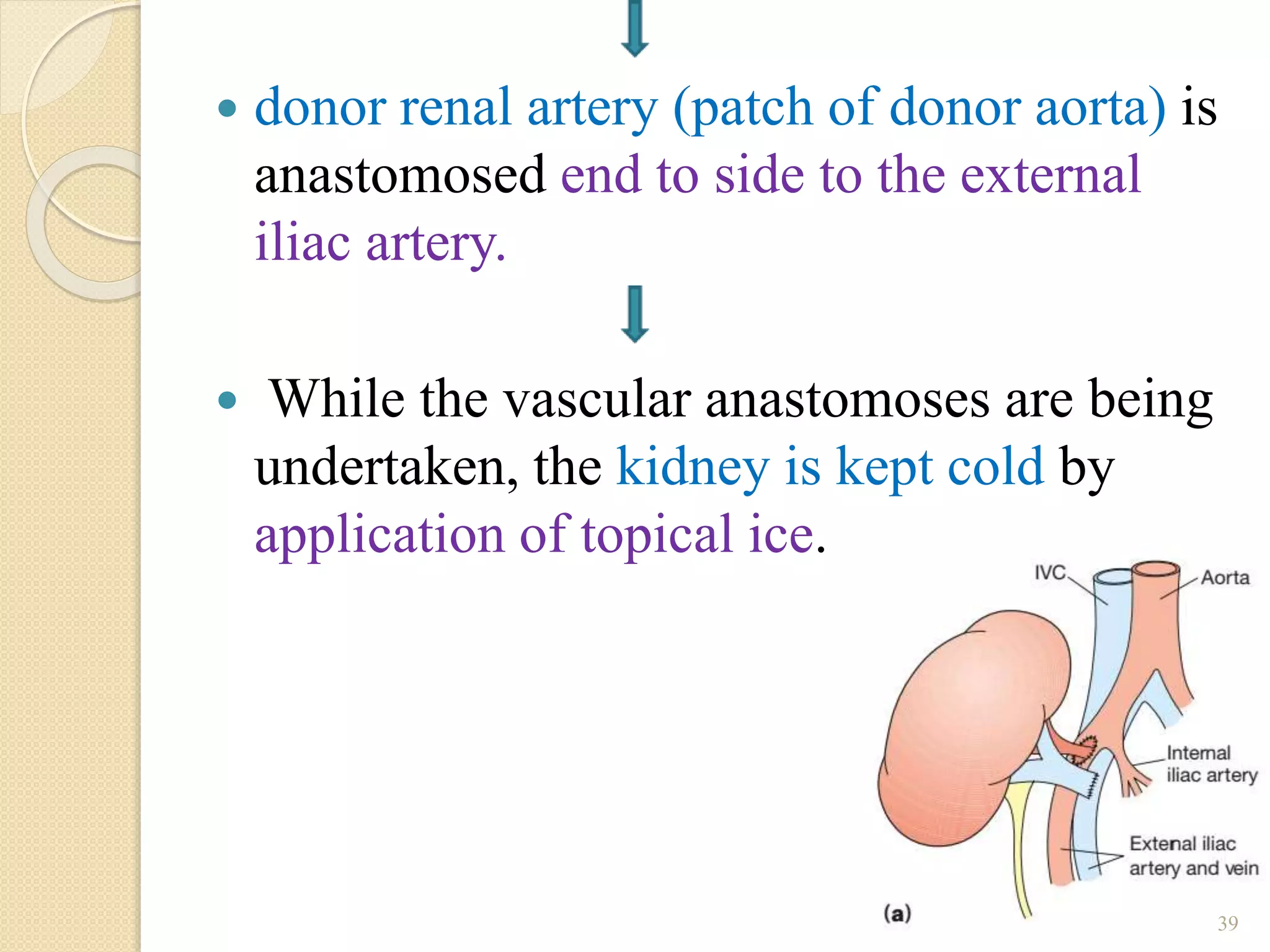 renal transplantation.pptx