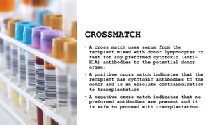 Renal Transplantation and Patients management | PPTX