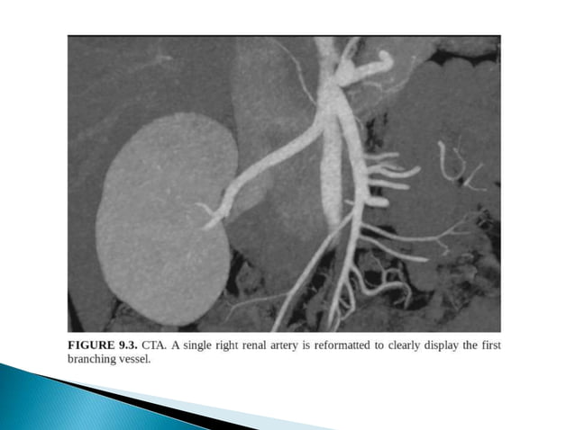 Renal transplant imaging | PPTX | Surgery | Medical Health