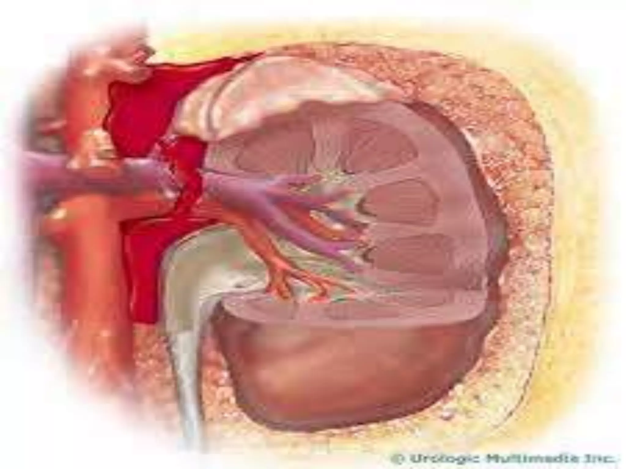 RENAL TRAUMA-FOR NEPHRO - UROLOGY STUDENTS | PPTX