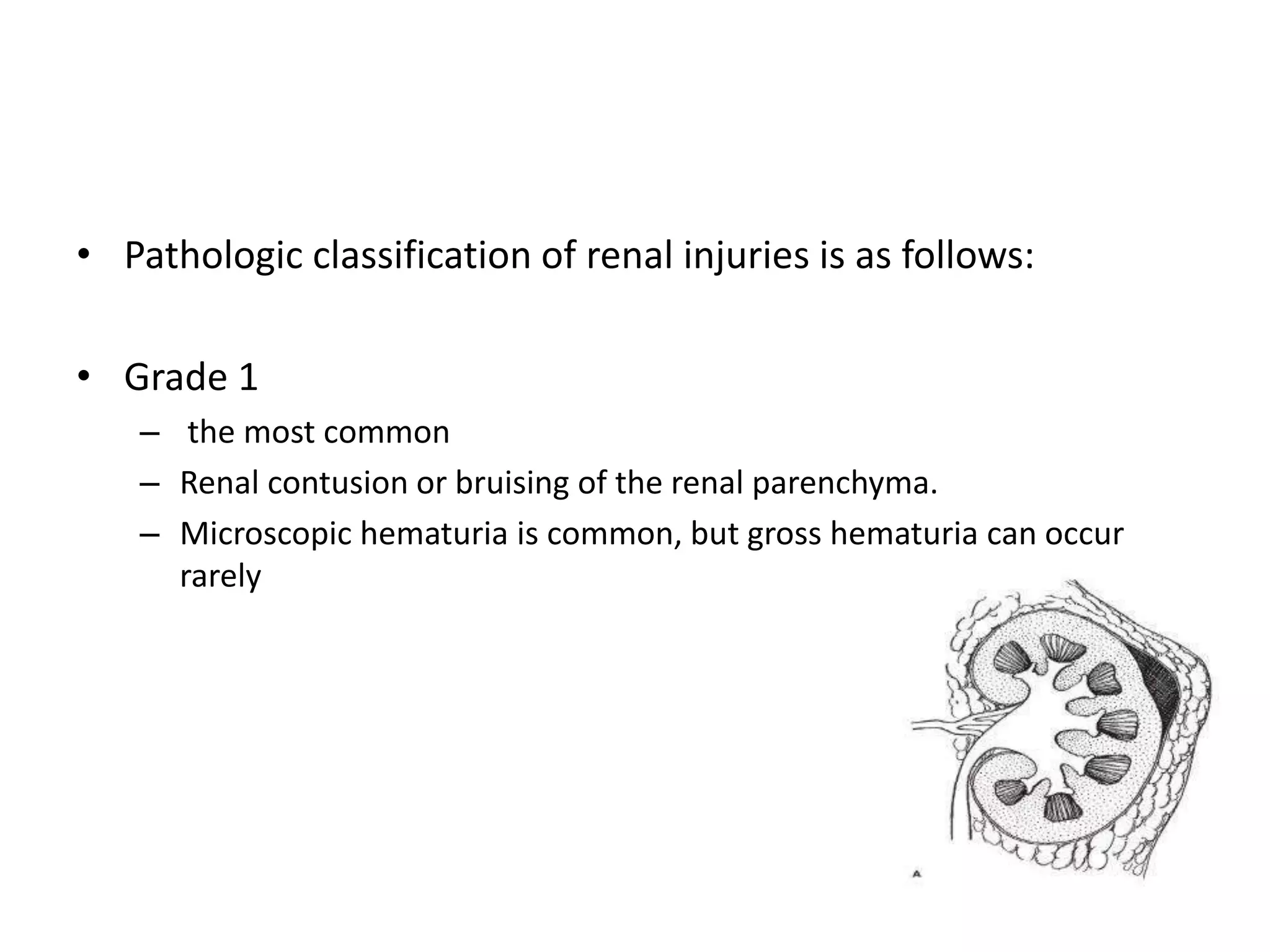 Renal trauma | PPTX