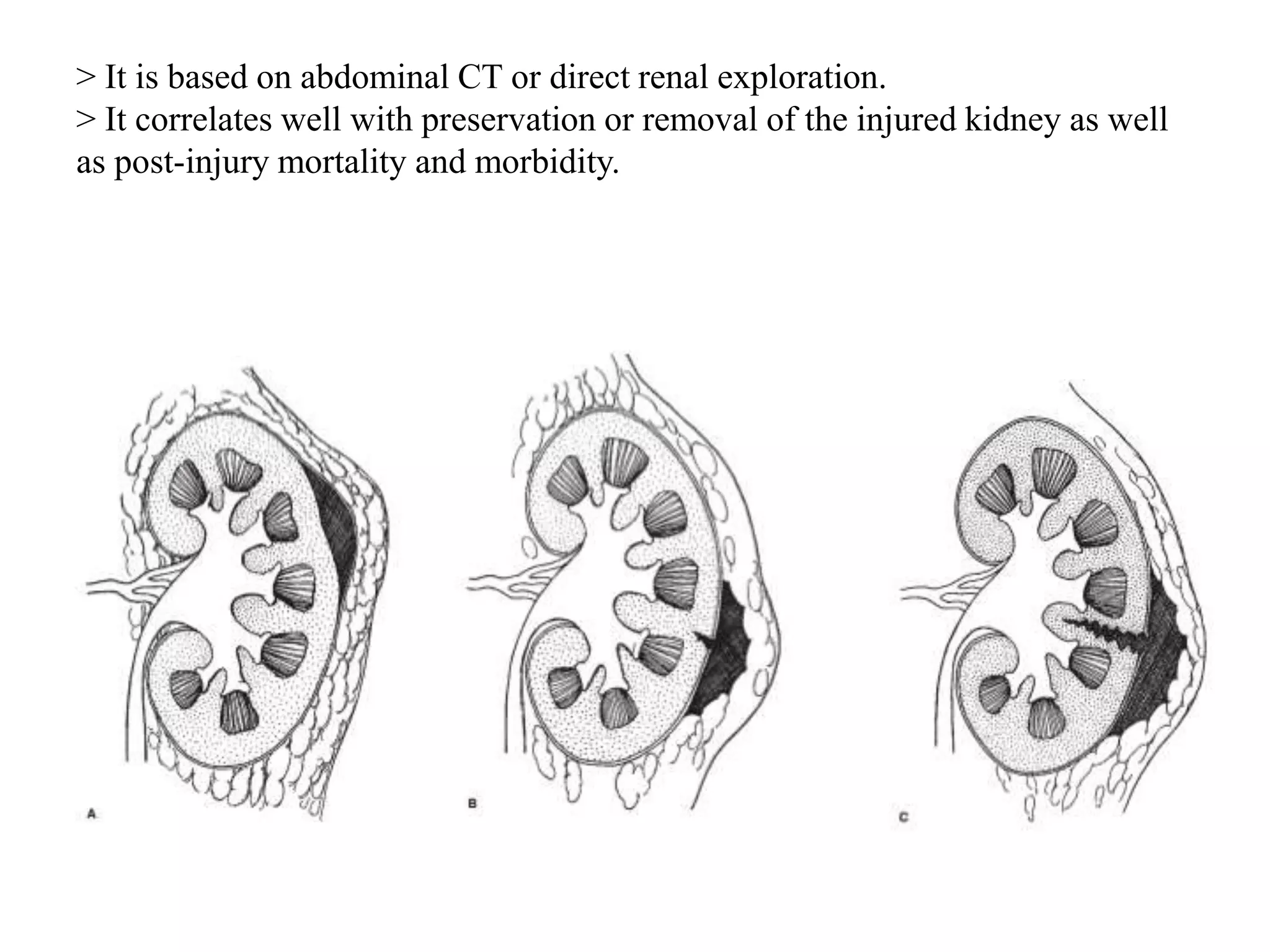 Renal trauma | PPTX