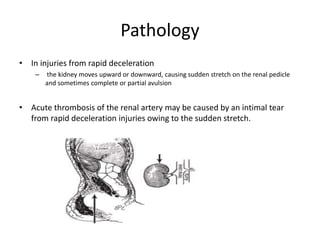 Renal trauma | PPTX