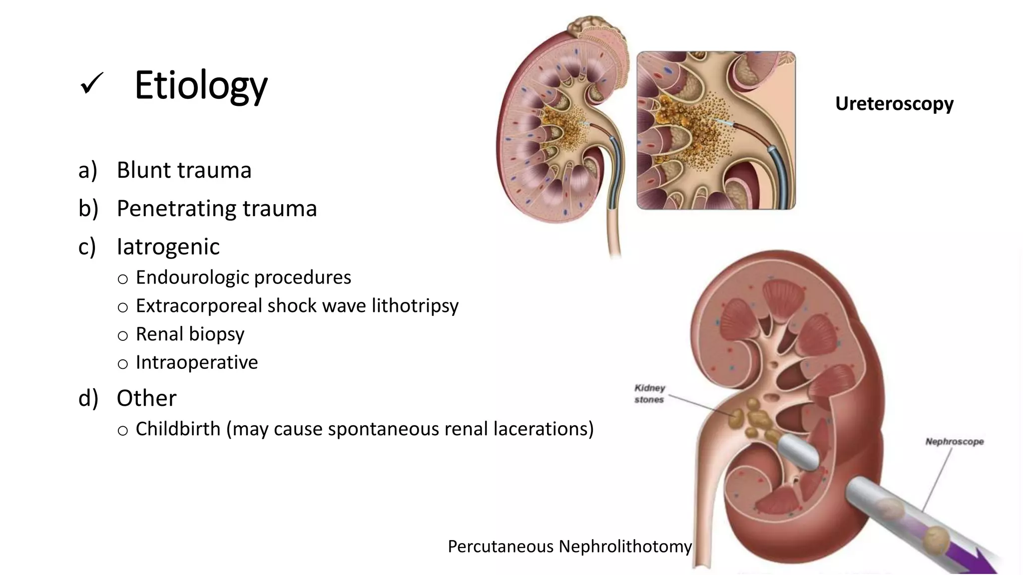 Renal trauma - Kidney trauma | PPTX