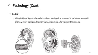 Renal trauma - Kidney trauma | PPTX