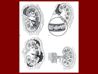 abdominal trauma and renal trauma injury.pptx